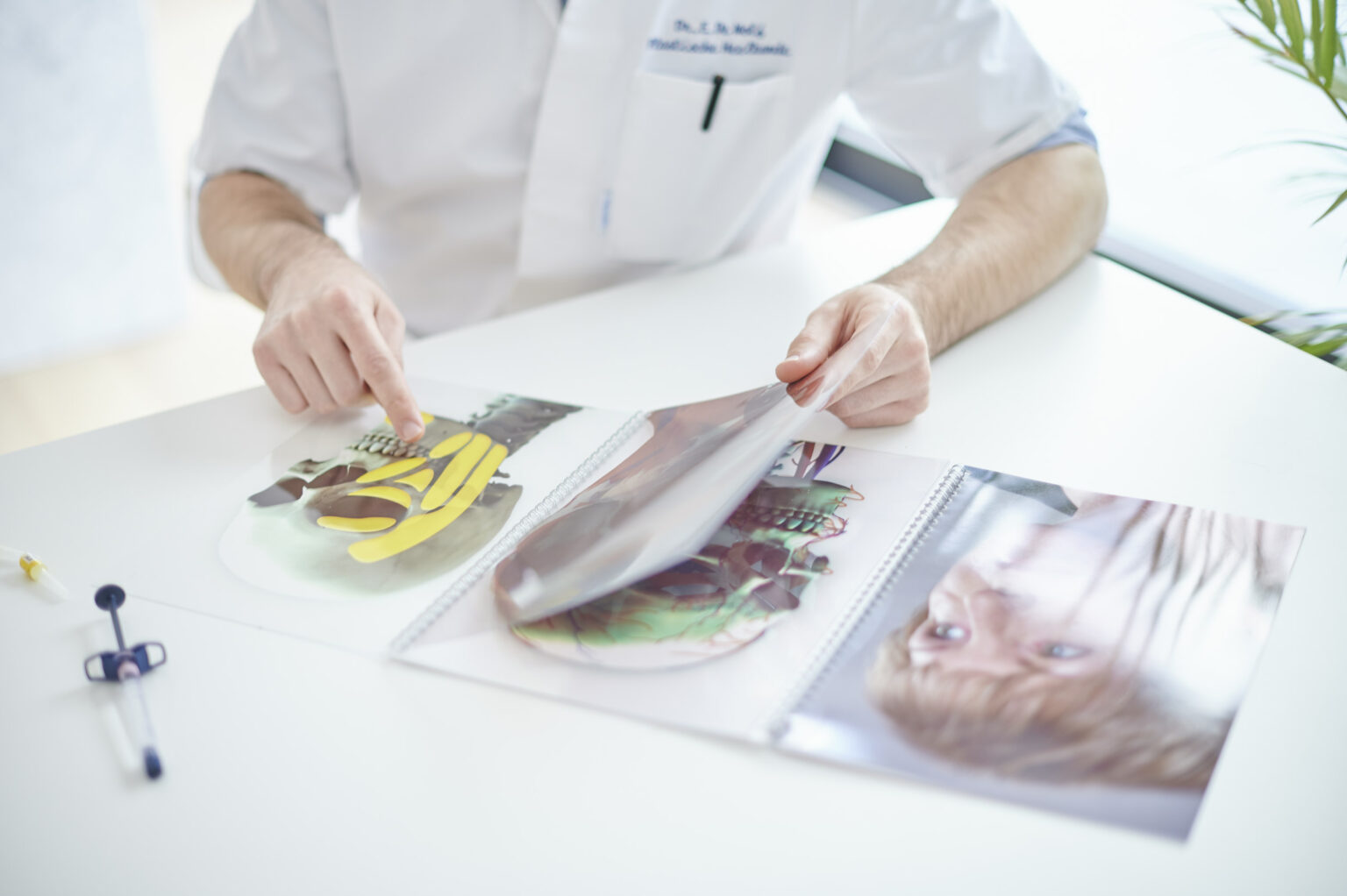 Borstlift • Dr. De Wolf • Plastische en esthetische heelkunde